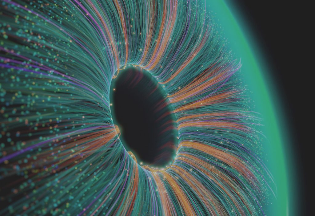 Laser Peripheral Iridotomy (LPI) - EyeHub